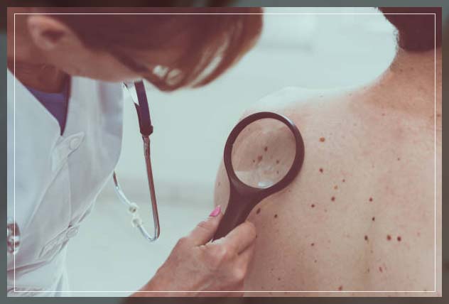 Mole Removal: Procedure and Aftercare - REPC