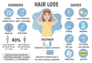 Alopecia Areata: Causes, Symptoms, and More - REPC