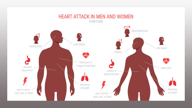 Cardiac Arrest: Learning all the Signs, Symptoms and More. - REPC