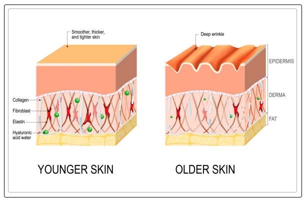 Collagen Injections: What you Need to Know? - REPC