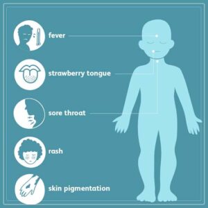 Scarlet Fever: Causes, Symptoms, Treatment, and More - REPC