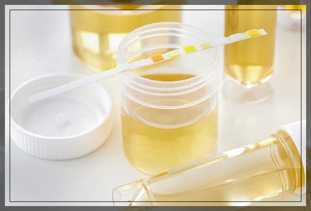 Urine Colors Explained - REPC